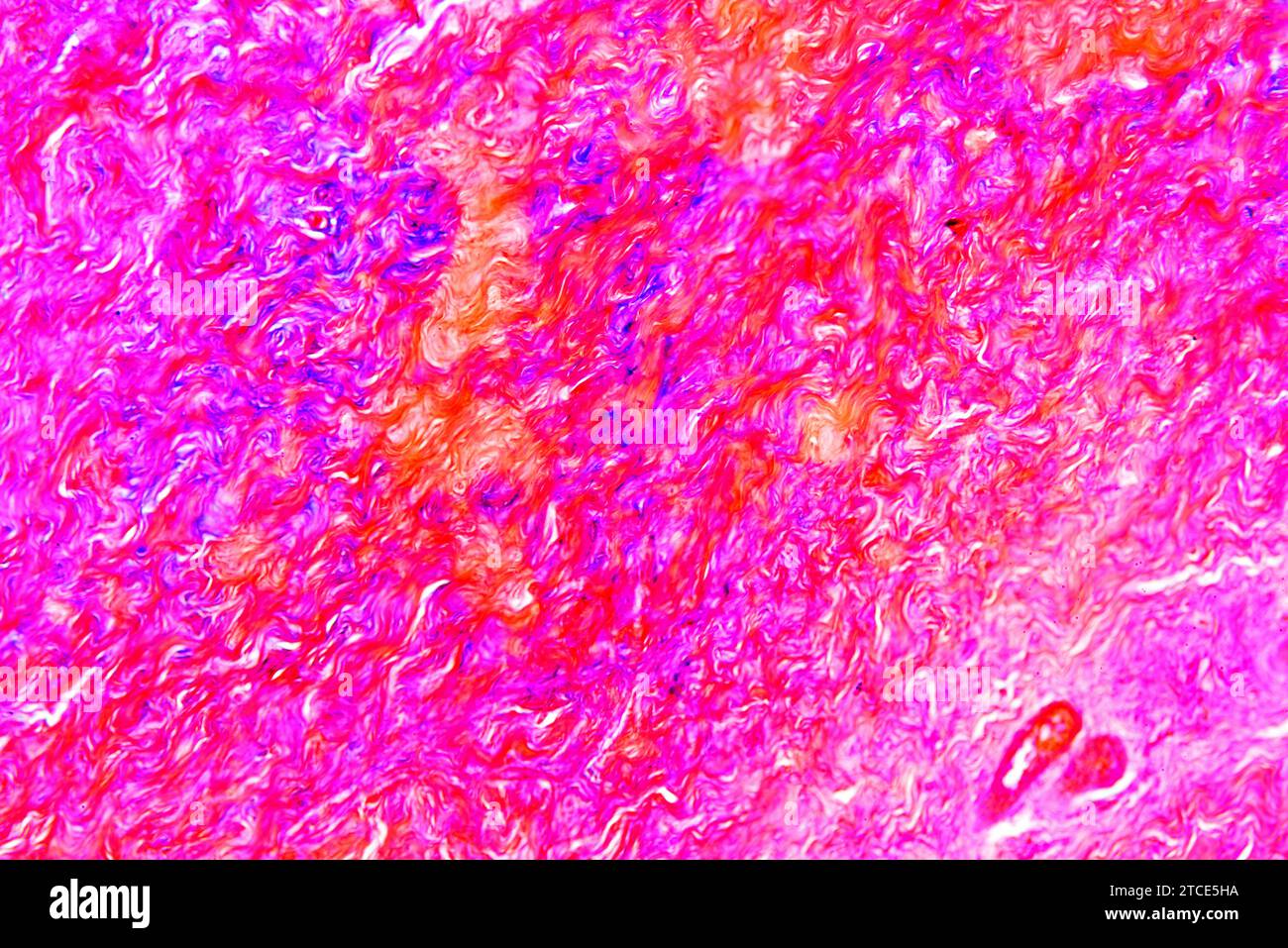 Fibrocartilage tissue showing collagen fibers. Optical microscope X100 ...