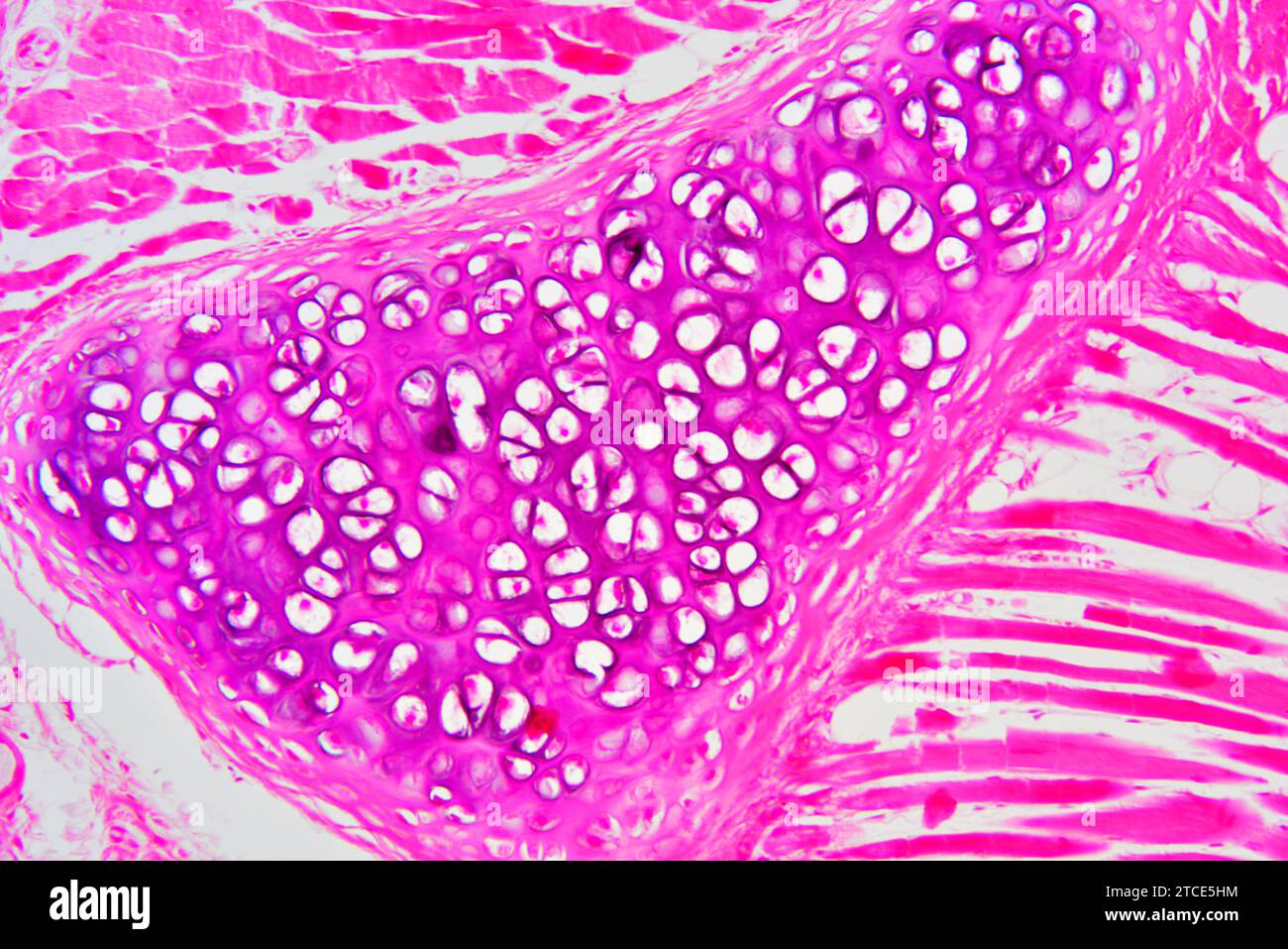 Hyaline cartilage from trachea showing chondrocytes, collagen fibers ...