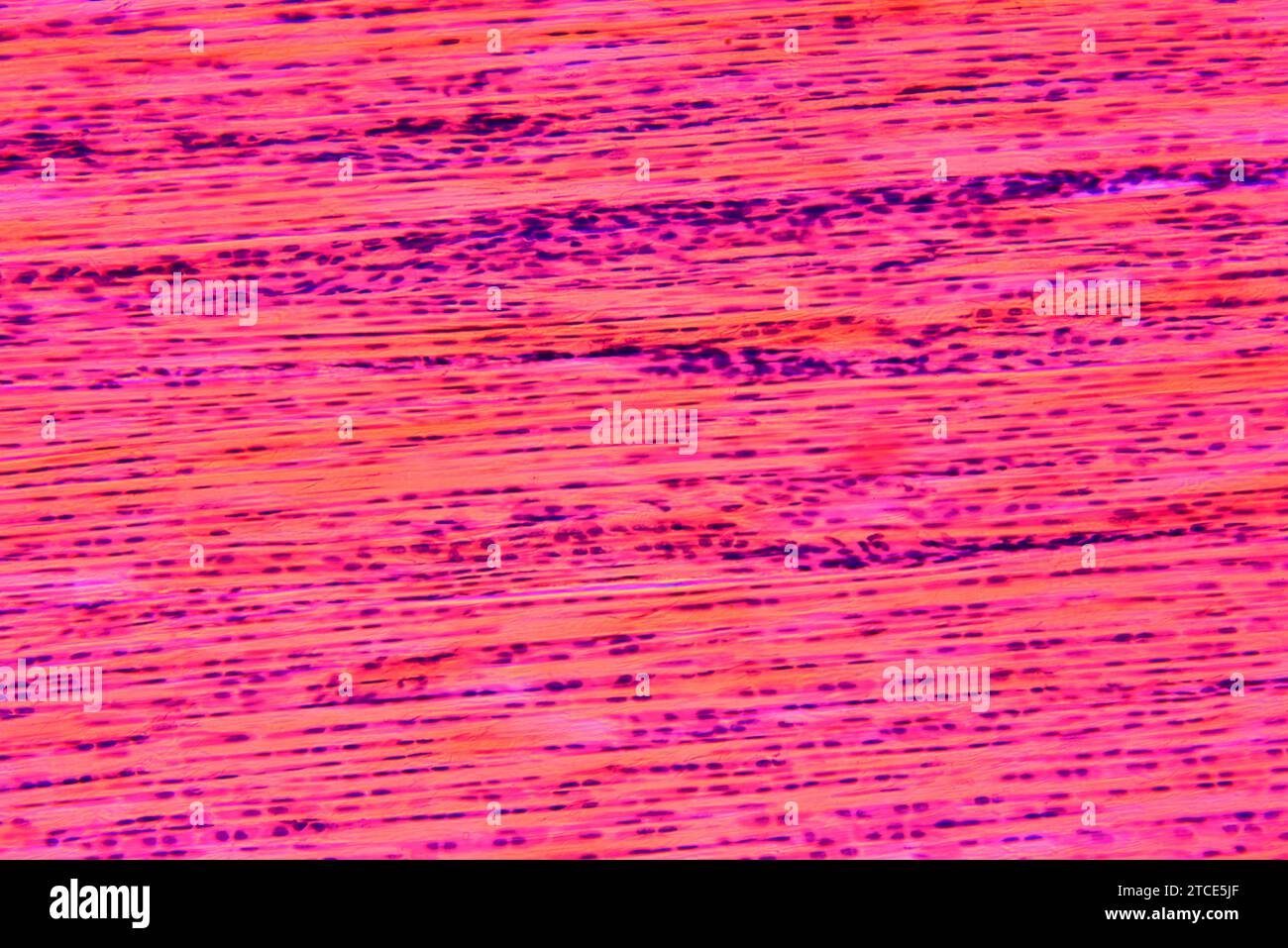 Dense Regular Tissue Under Microscope