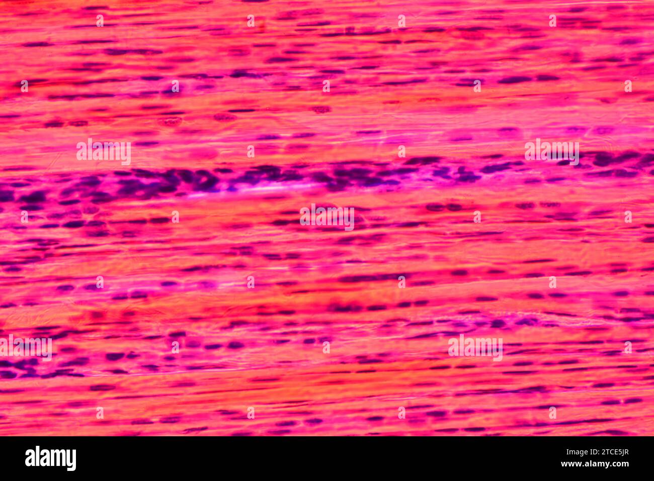 Dense connective tissue or dense fibrous tissue showing fibroblasts ...