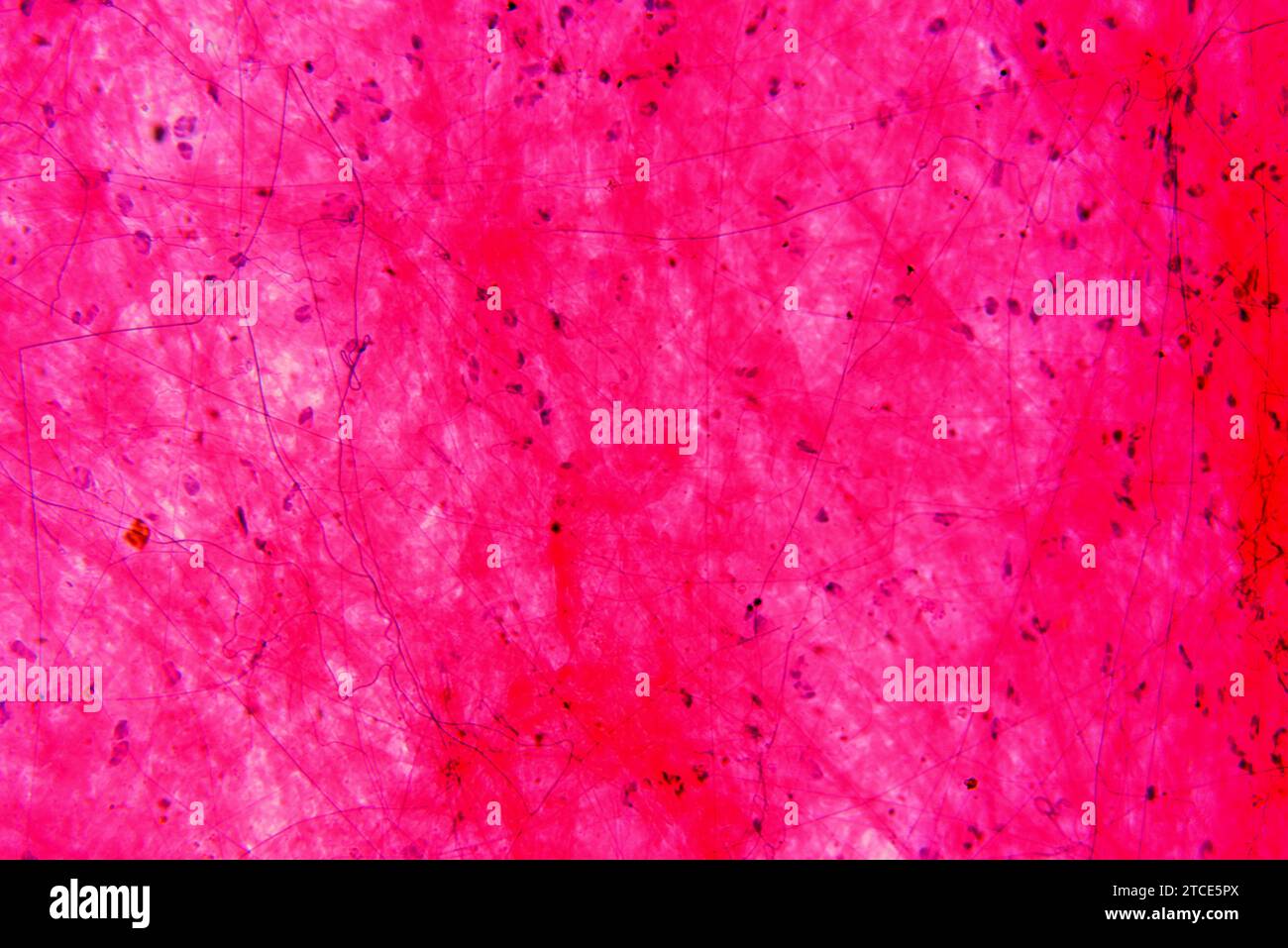 Reticular connective tissue hi-res stock photography and images - Alamy