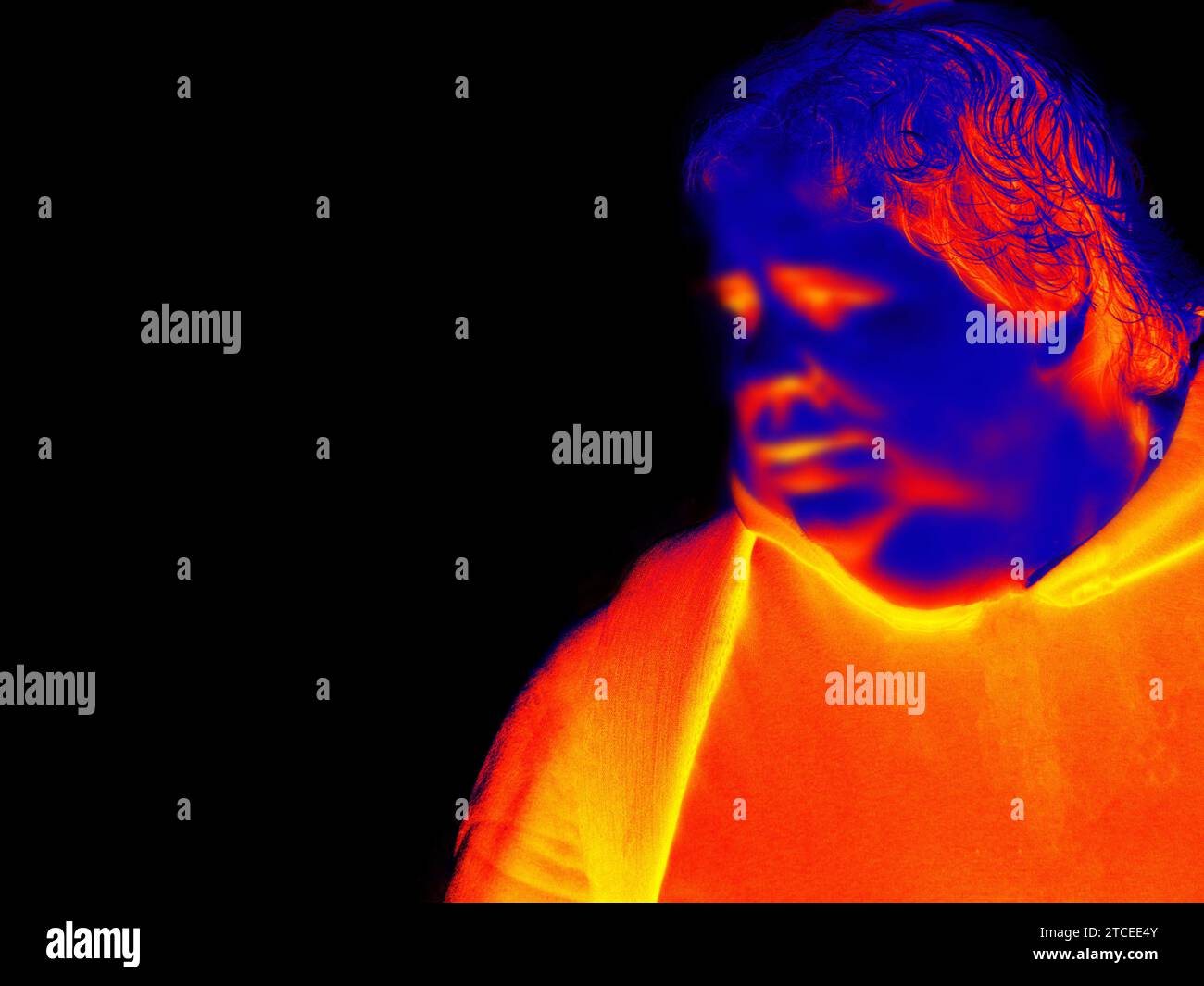 Fat man with greasy hair, the glutton, adiposity (eating disorder ...