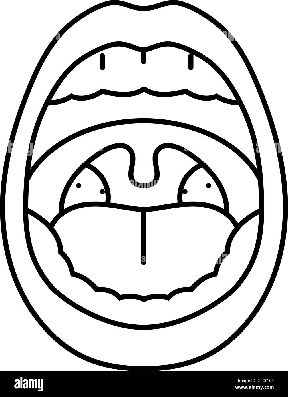 swollen tonsils disease symptom line icon vector illustration Stock ...