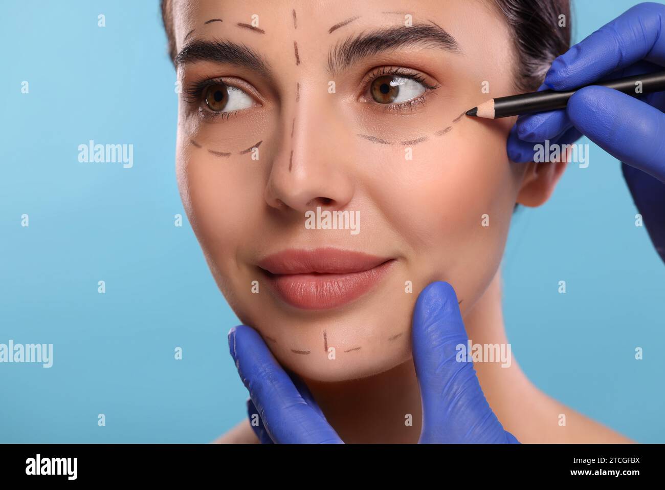 Doctor drawing marks on woman's face for cosmetic surgery operation ...