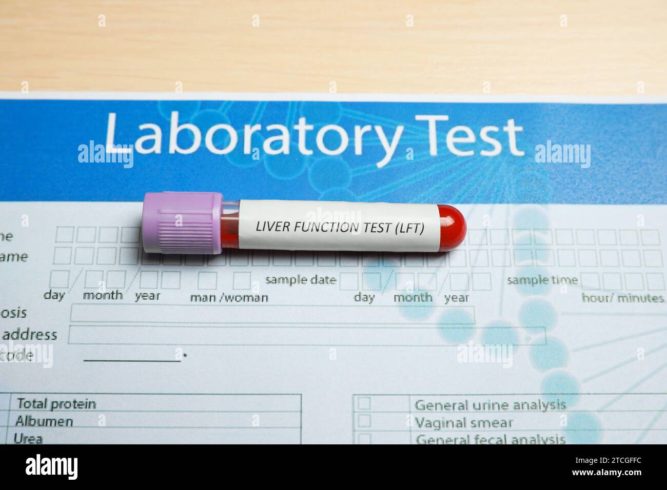 Liver Function Test. Tube with blood sample and laboratory form on ...