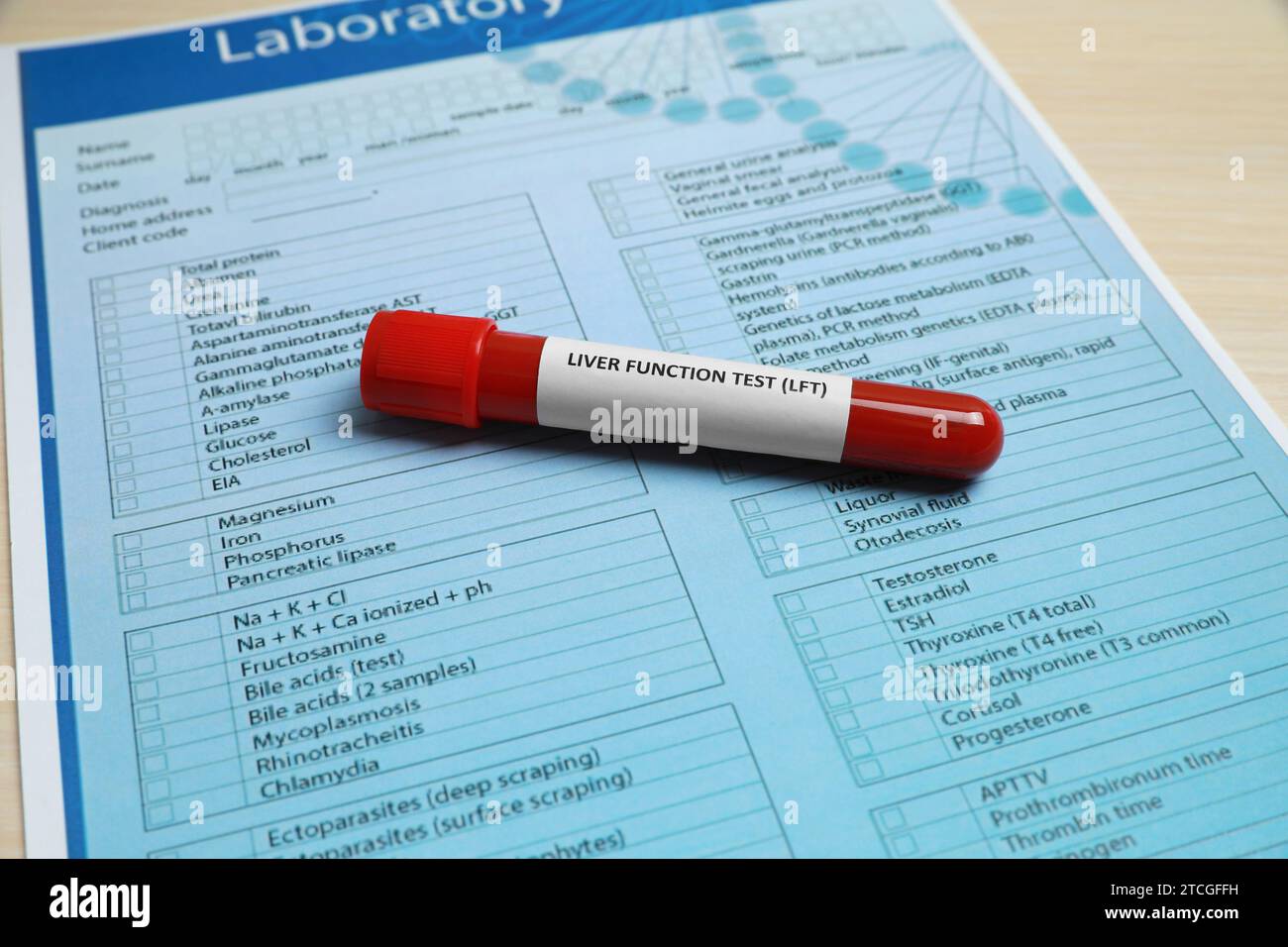 Liver Function Test. Tube with blood sample and laboratory form on ...