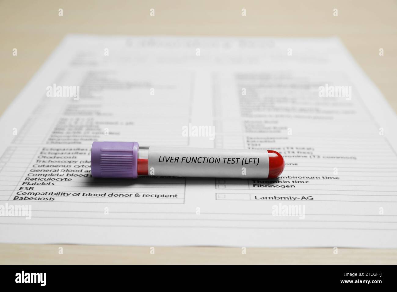 Liver Function Test. Tube with blood sample and laboratory form on ...
