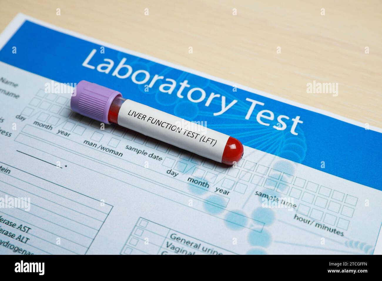 Liver Function Test. Tube with blood sample and laboratory form on ...