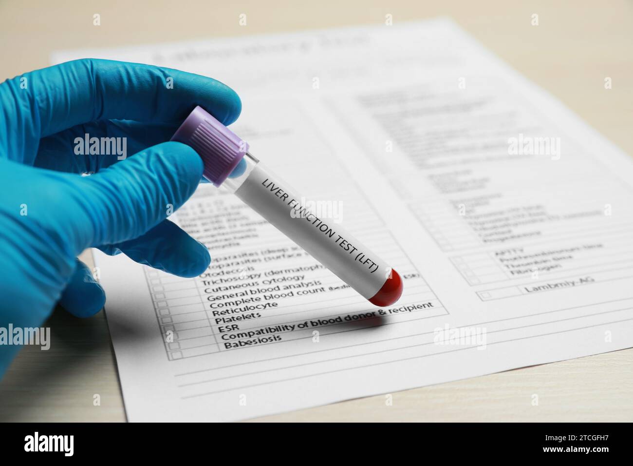 Liver Function Test. Laboratory worker with tube of blood sample and ...