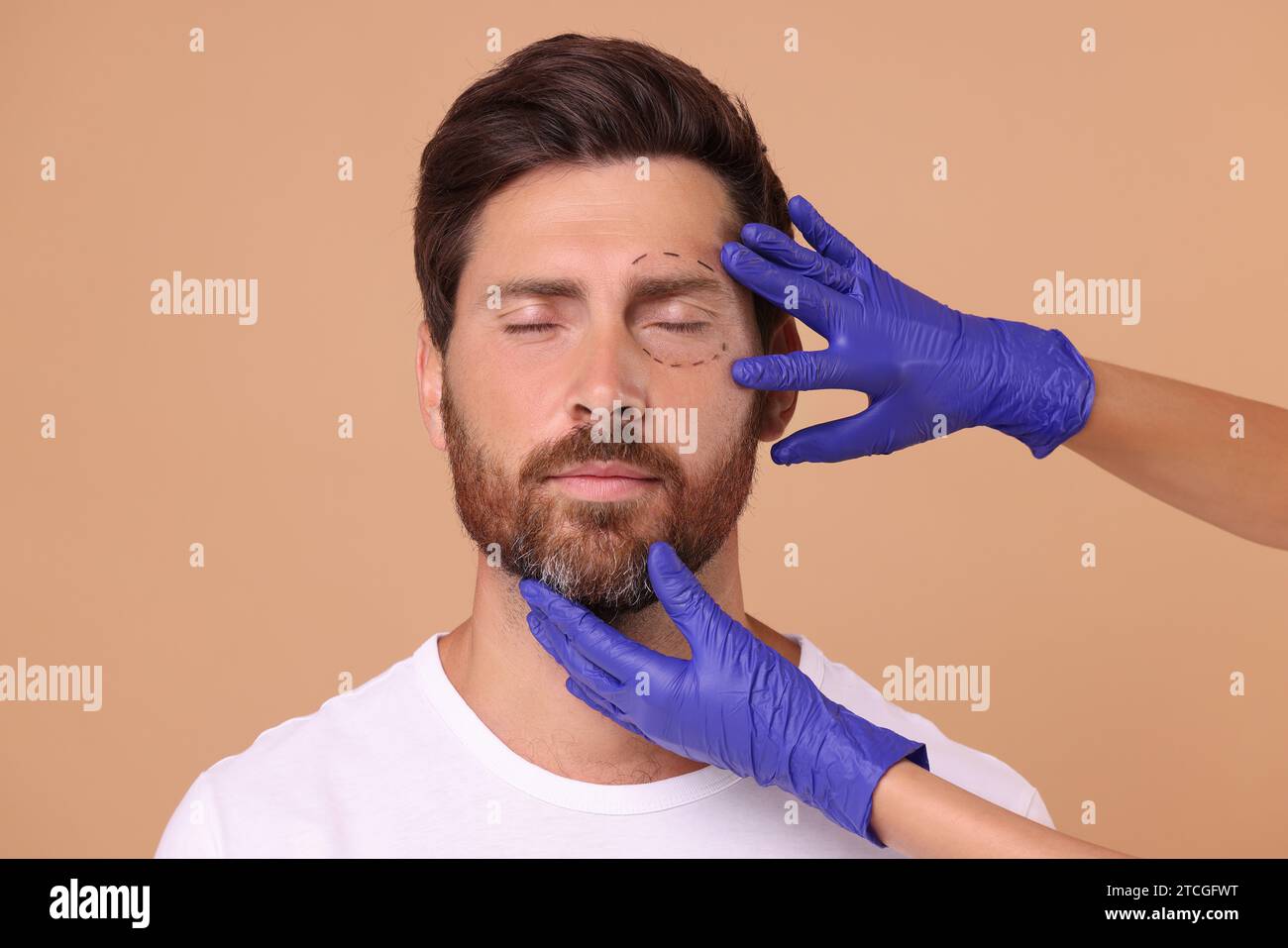 Doctor checking marks man's on face for cosmetic surgery operation ...