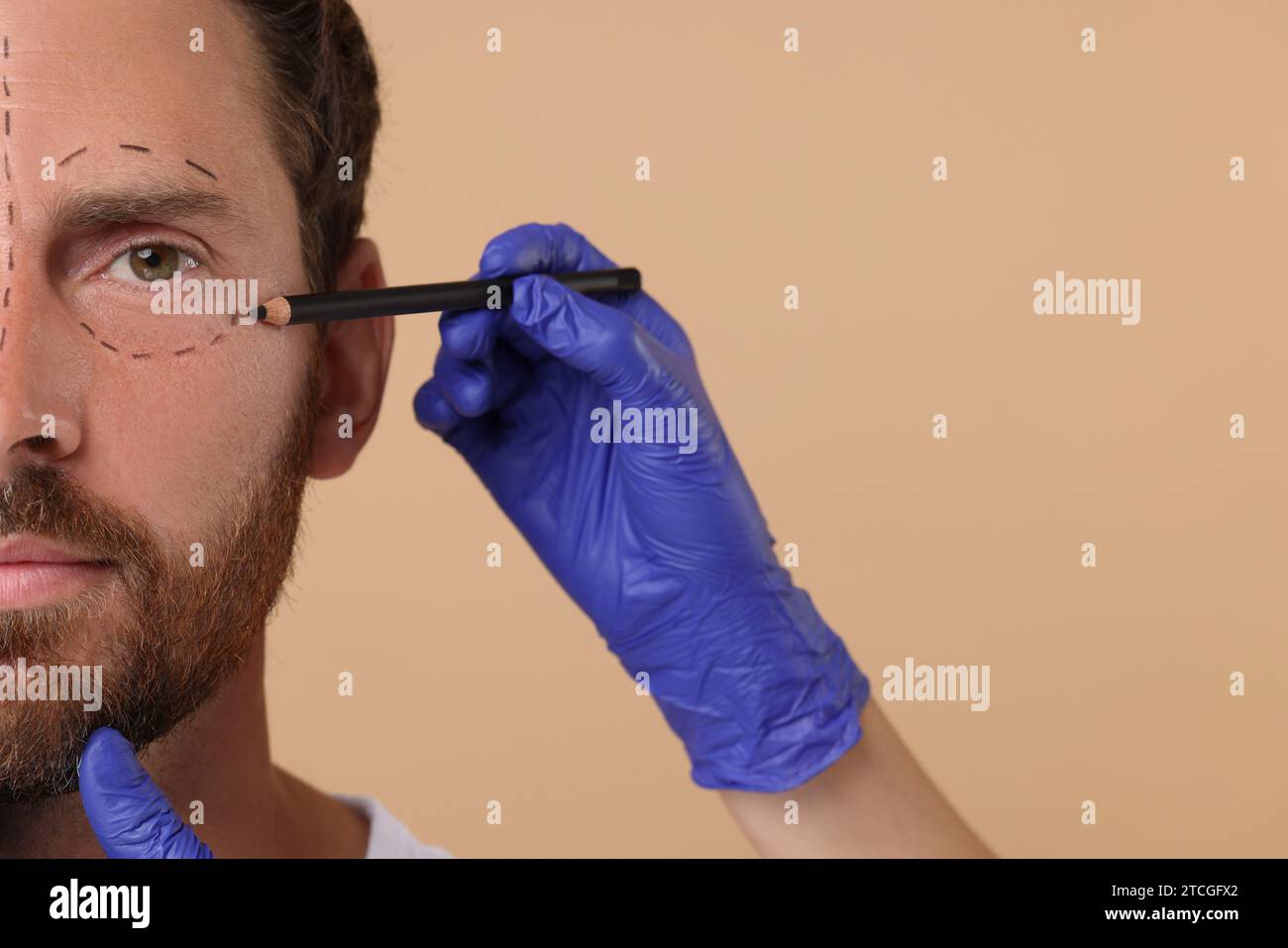 Doctor drawing marks on man's face for cosmetic surgery operation ...