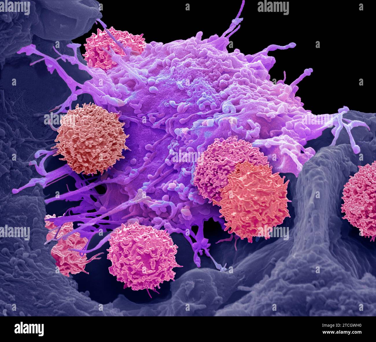 (CAR) T-cell therapy. Composite coloured scanning electron micrograph ...