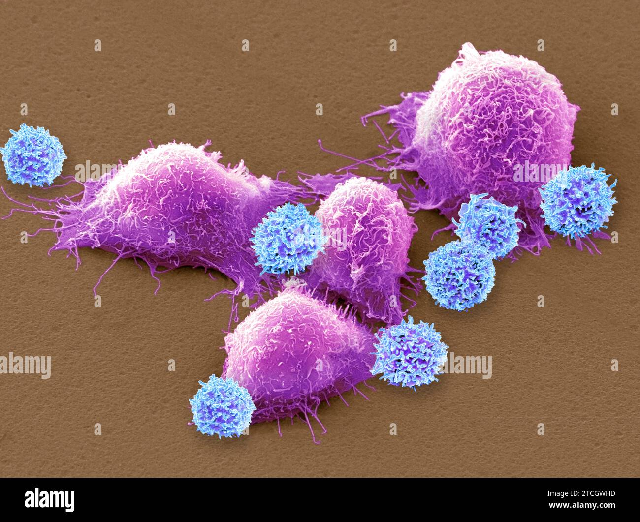 (CAR) T-cell therapy. Composite coloured scanning electron micrograph ...
