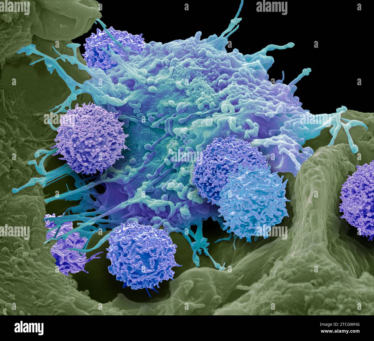 (CAR) T-cell therapy. Composite coloured scanning electron micrograph ...
