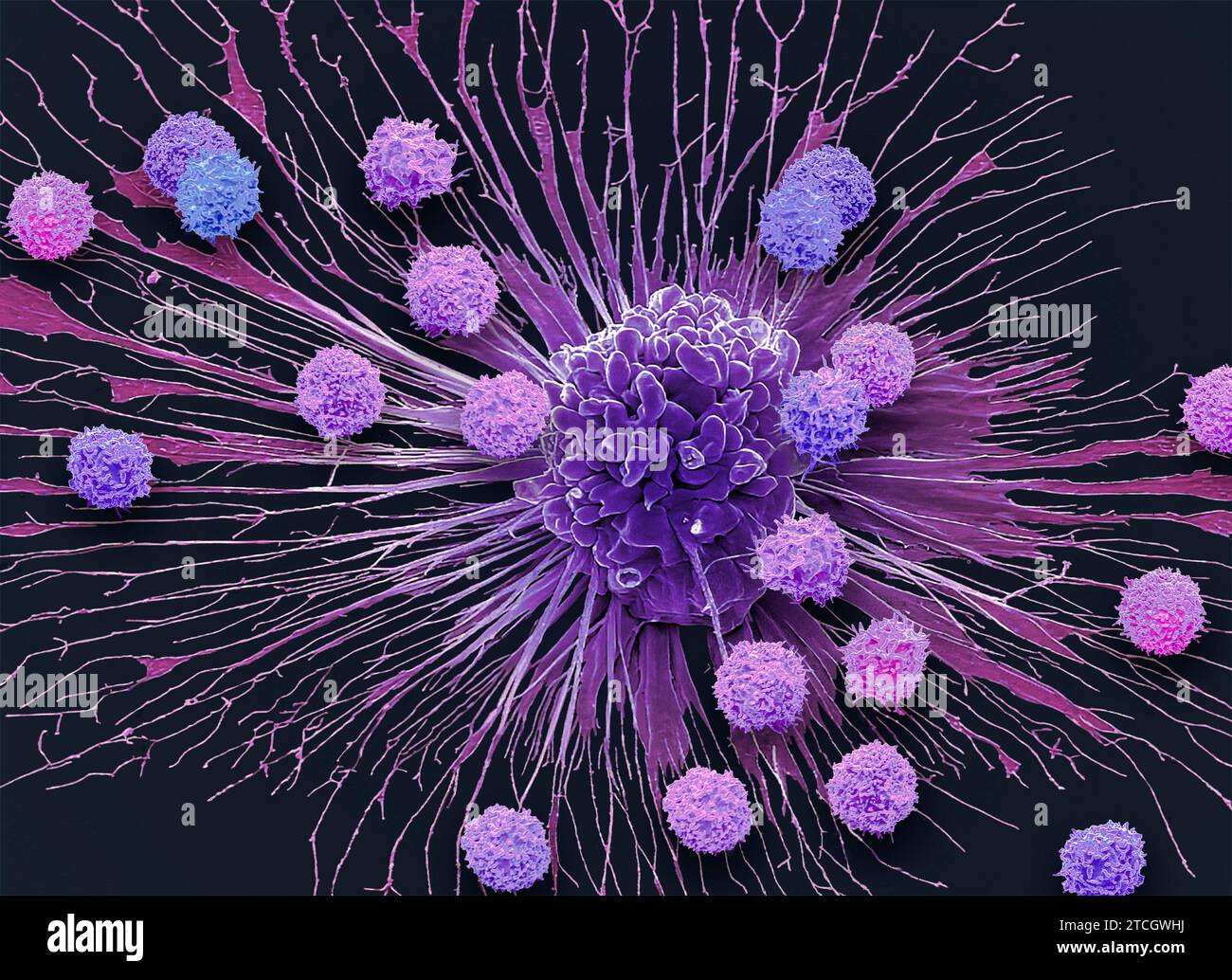 (CAR) T-cell therapy. Composite coloured scanning electron micrograph ...