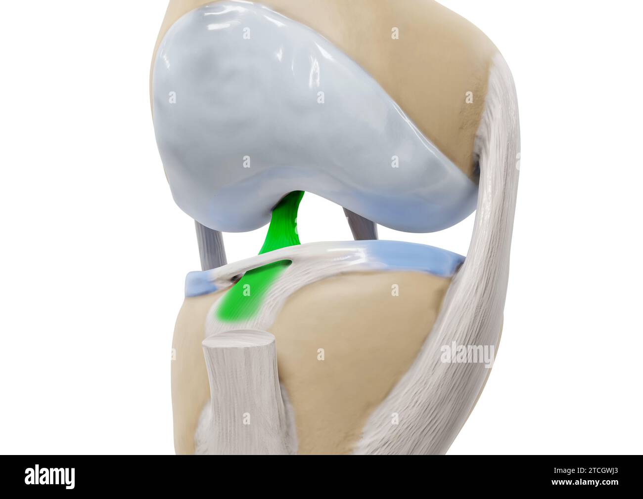 Illustration of the anatomy of the anterior cruciate ligament of a ...