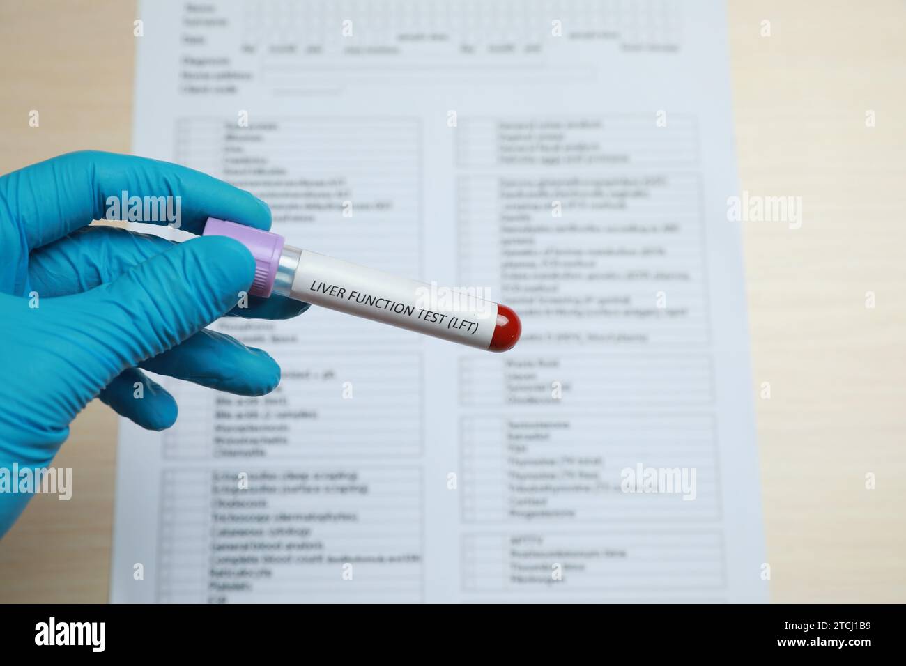 Laboratory worker holding tube with blood sample and label Liver ...
