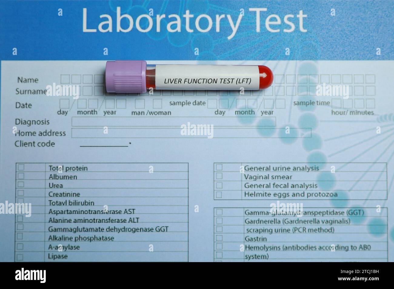 Liver Function Test. Tube with blood sample on laboratory form, top ...