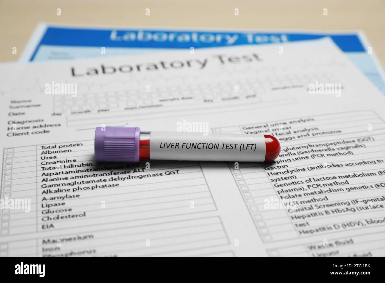 Liver Function Test. Tube with blood sample and laboratory forms on ...