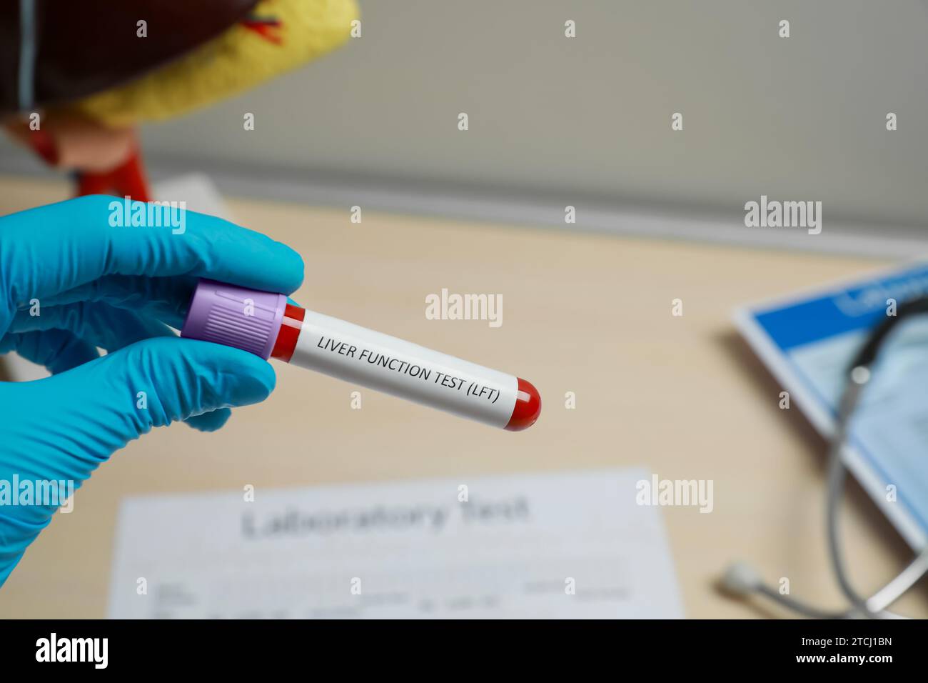 Laboratory worker holding tube with blood sample and label Liver ...