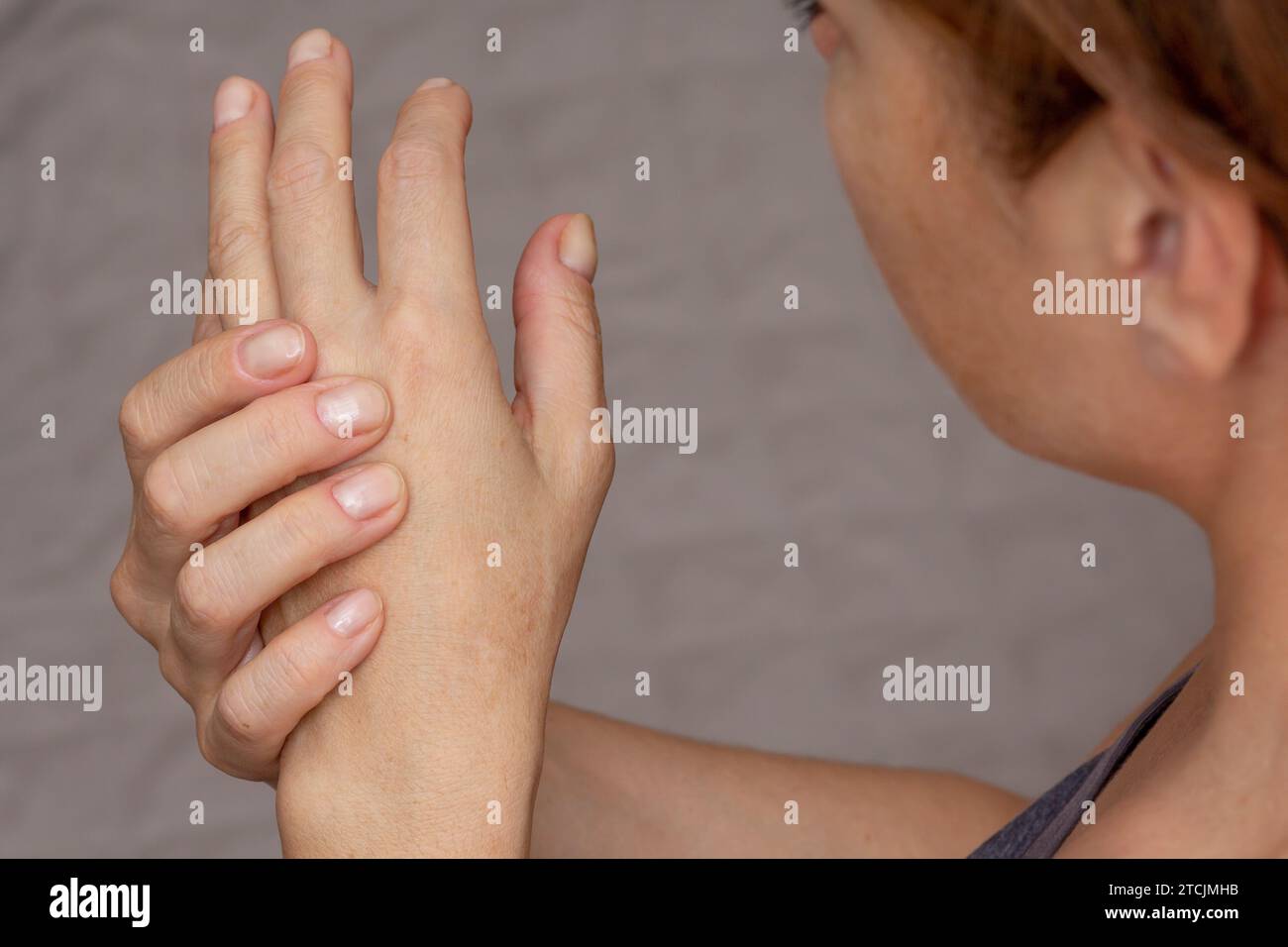 Woman hands showing numb hand Stock Photo - Alamy