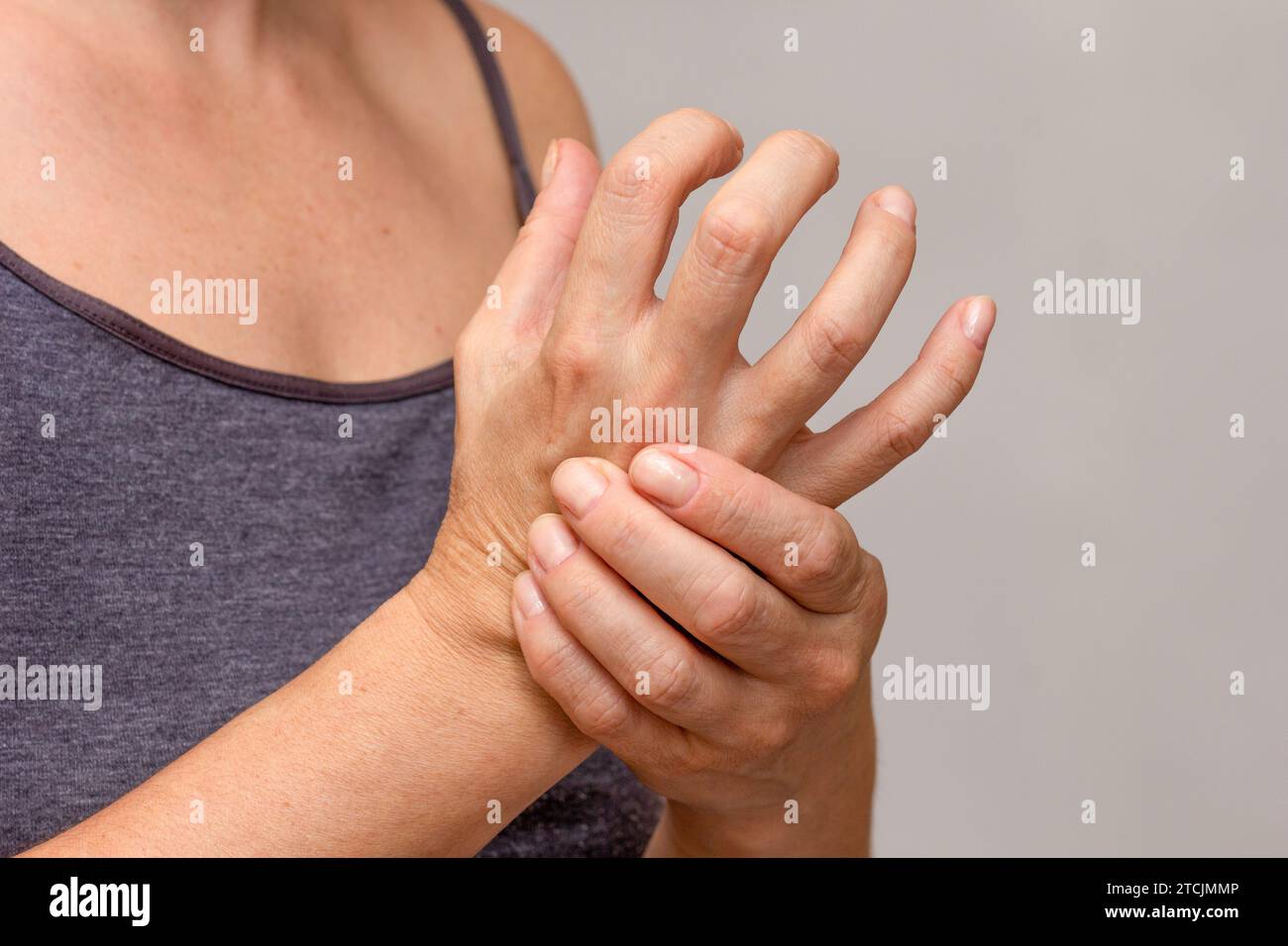 Swelling stiffness and inflammation of hands hi-res stock photography ...