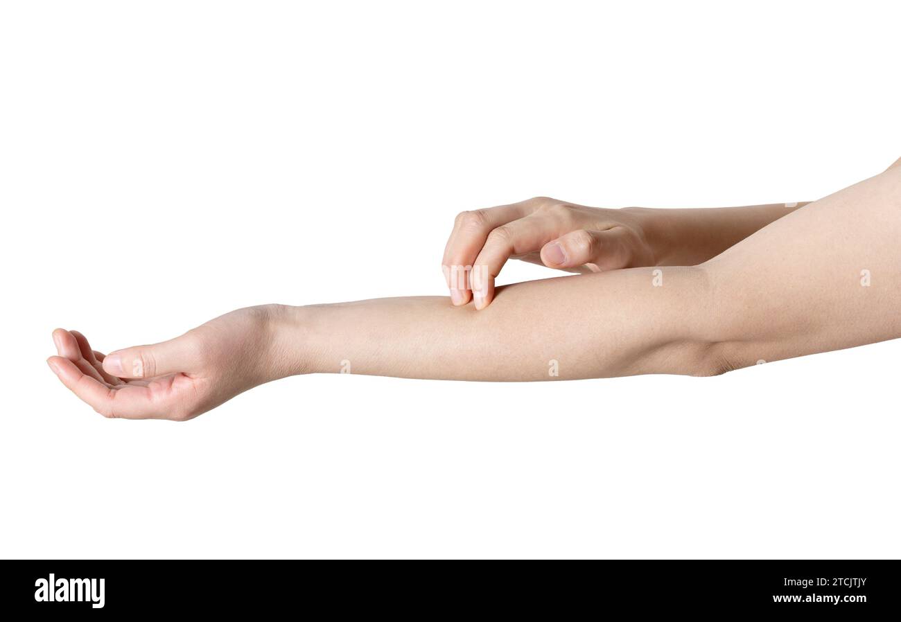 Woman suffering from itching scratches her arm (isolated on white ...