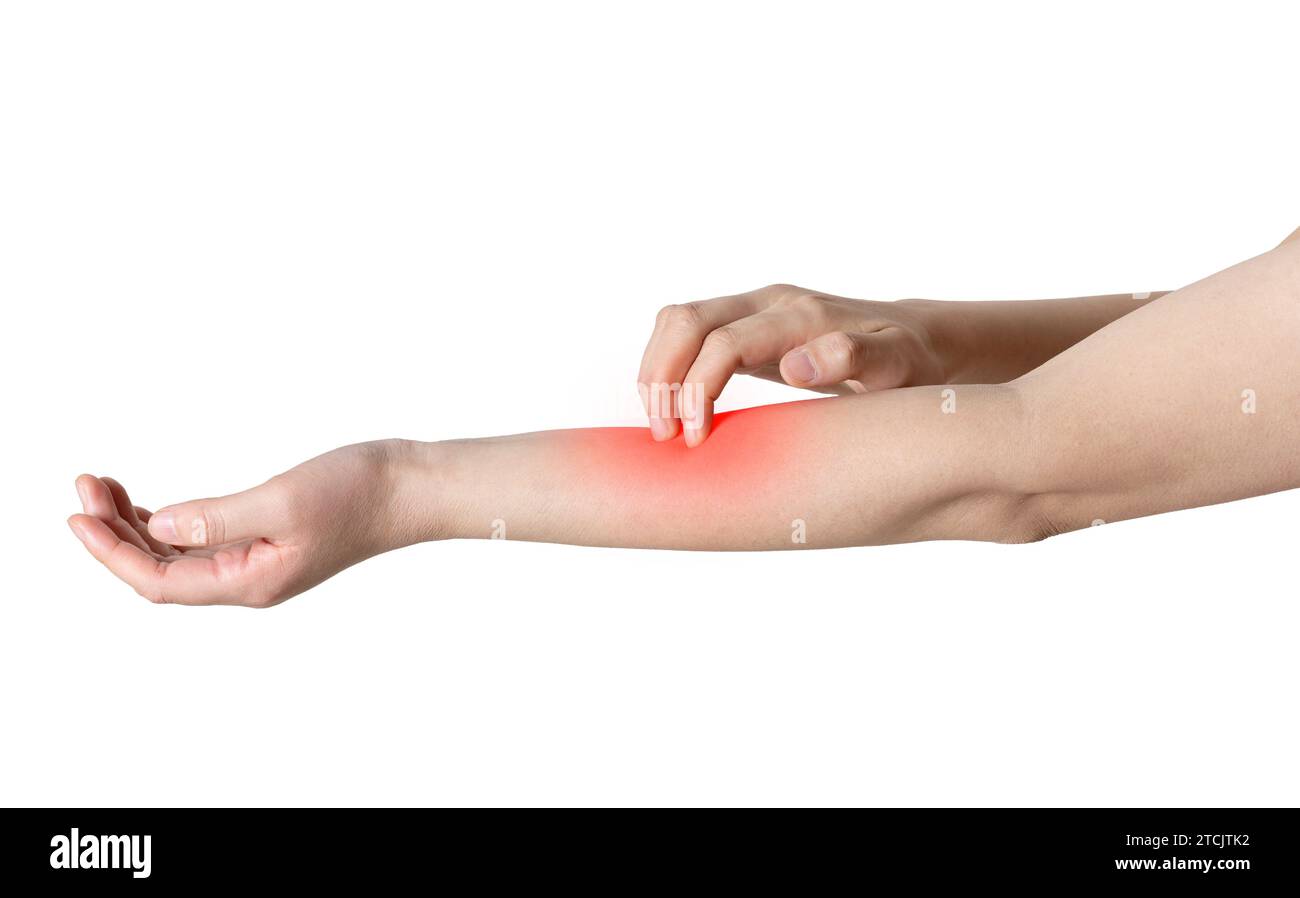 An itchy woman scratches her arm (isolated on white background ...