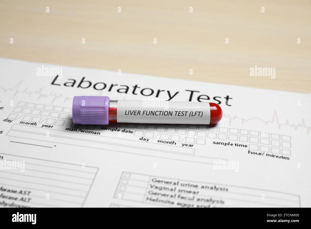 Liver Function Test. Tube with blood sample and laboratory form on ...