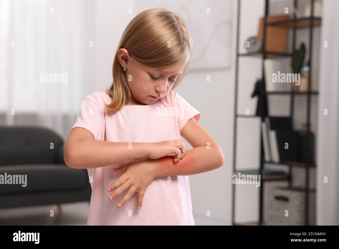 Suffering from allergy. Little girl scratching her arm at home Stock ...