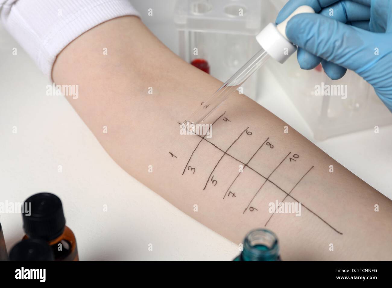 Doctor doing skin allergy test at light table, closeup Stock Photo - Alamy