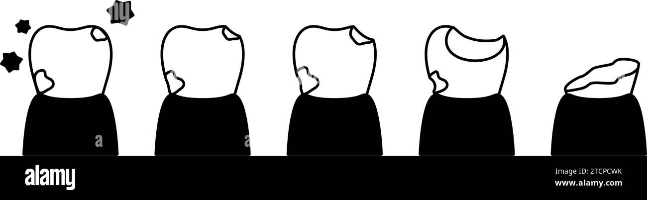 Illustration of image of cavity progression, simple line drawing ...