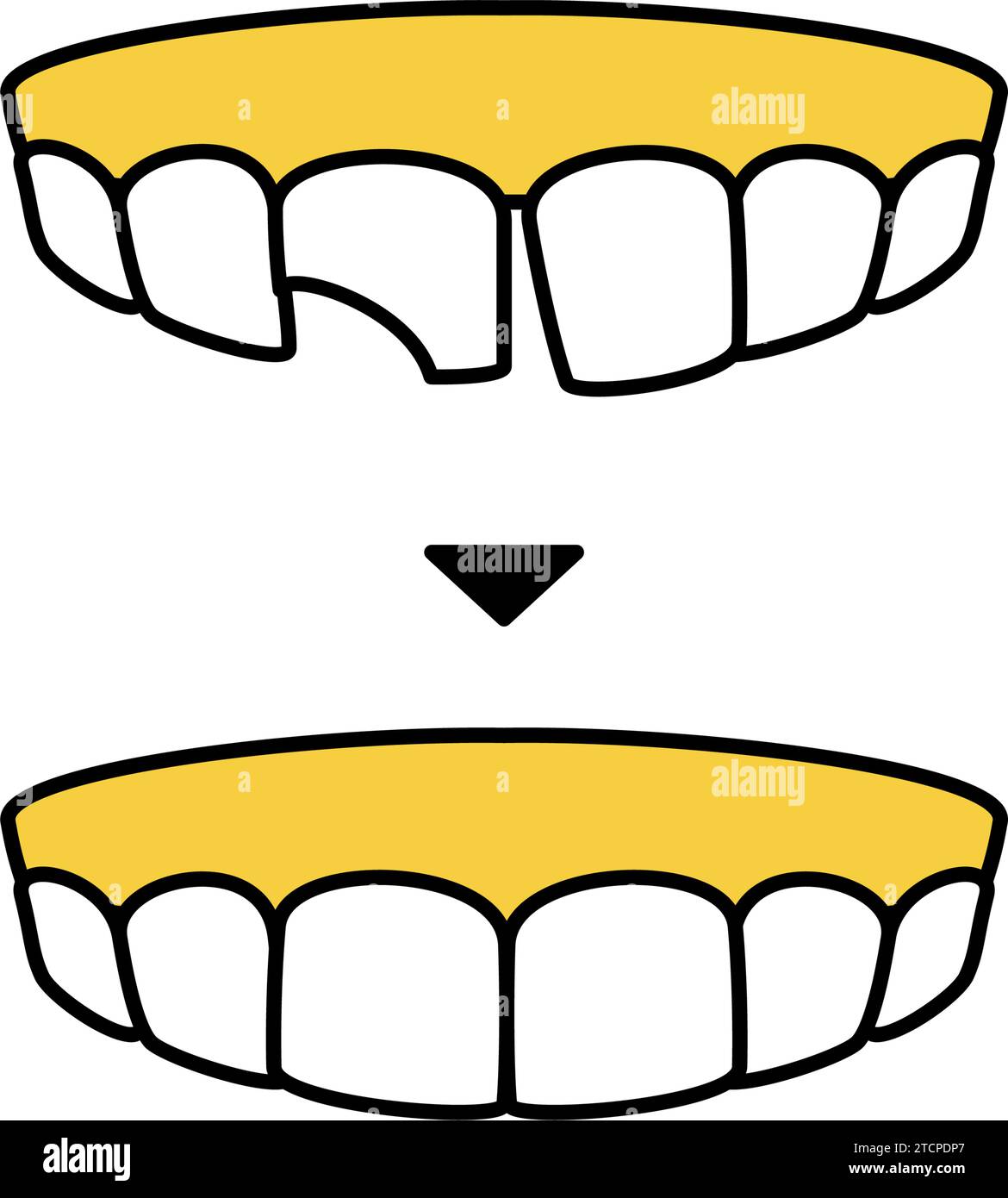 Cosmetic dentistry, direct bonding before and after, simple line ...