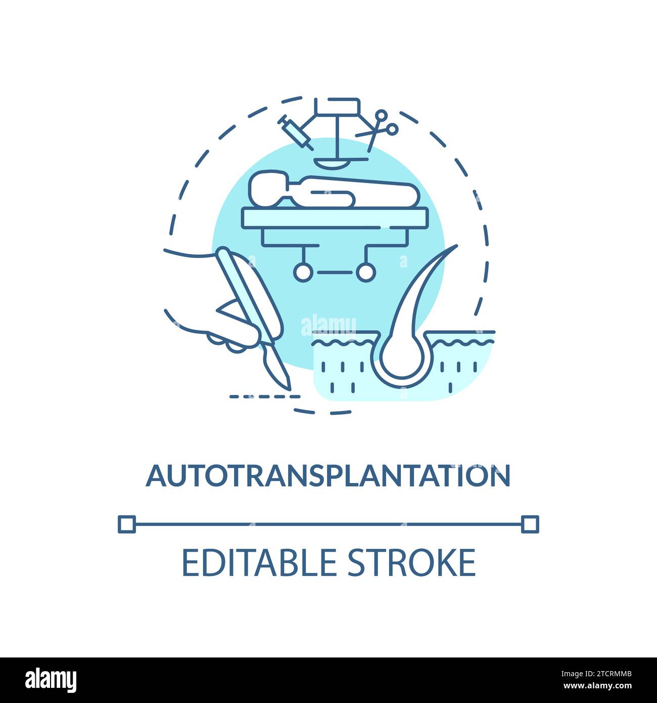 Autotransplantation hi-res stock photography and images - Alamy