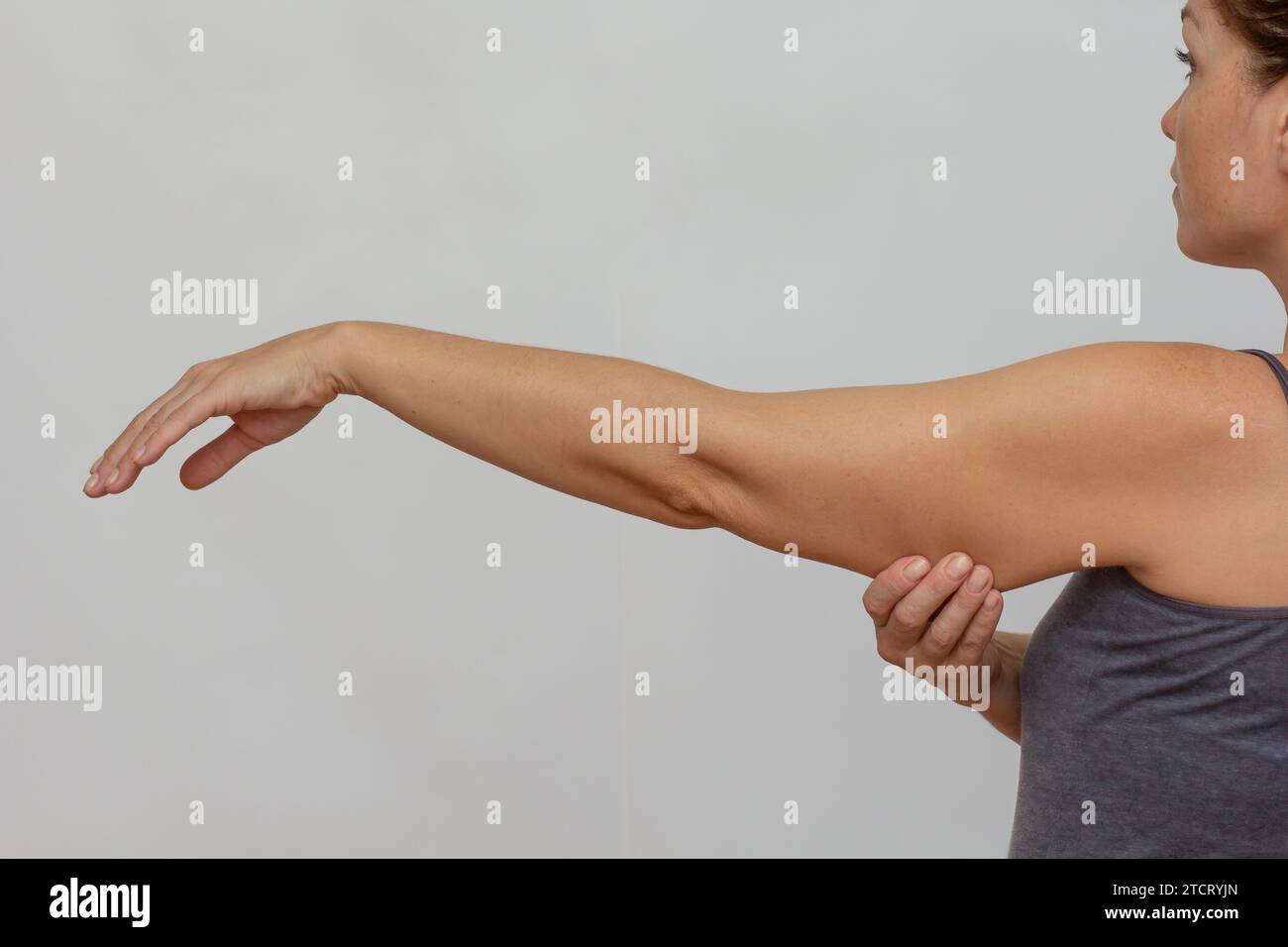 Cropped woman body showing arm with sagging skin Stock Photo - Alamy