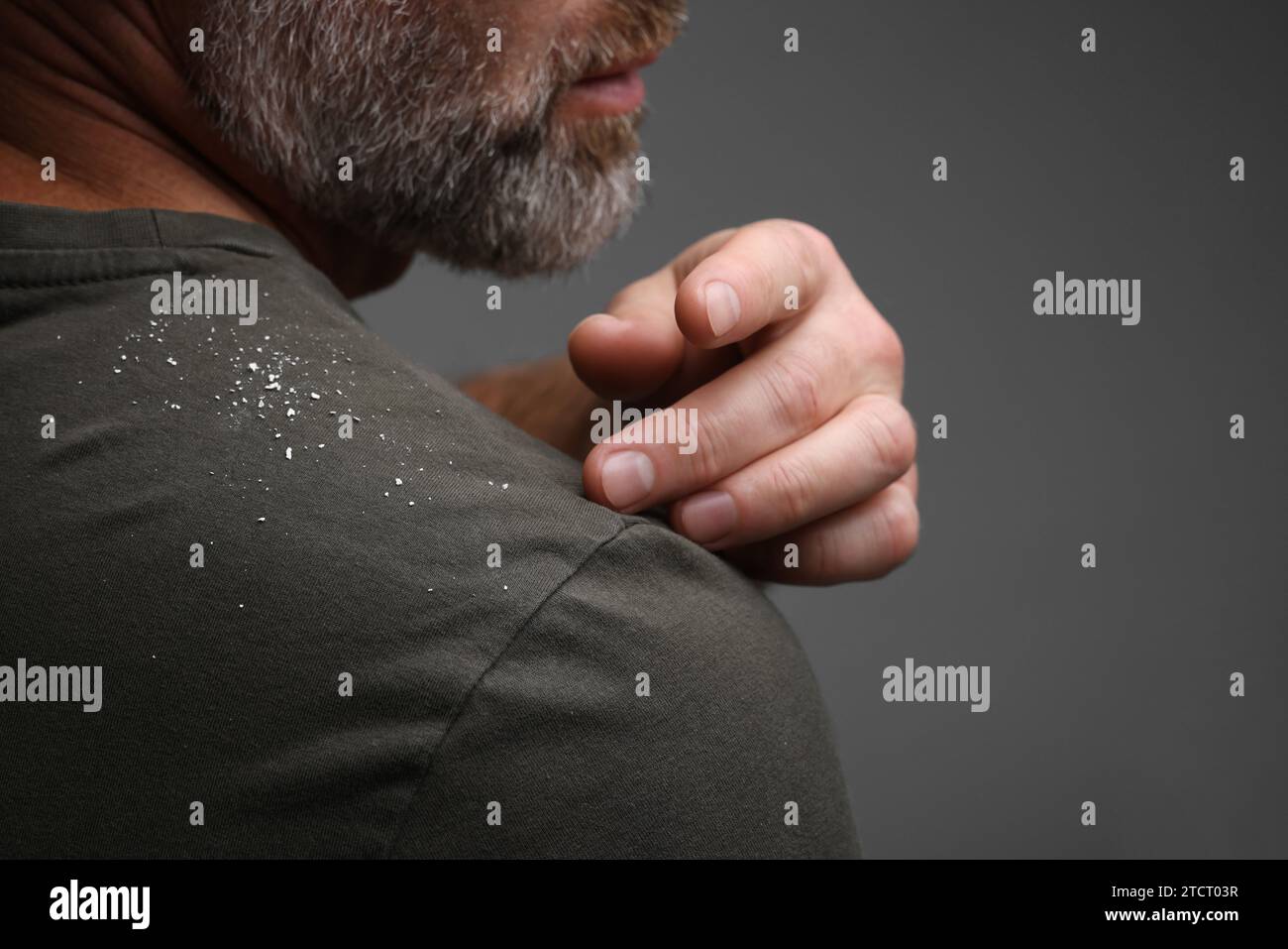 Bearded man brushing dandruff off his t-shirt on grey background ...