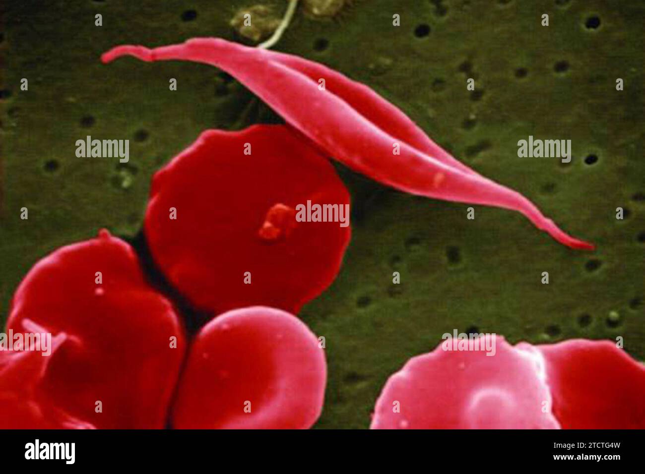 This electron microscope image provided by the National Institutes of ...