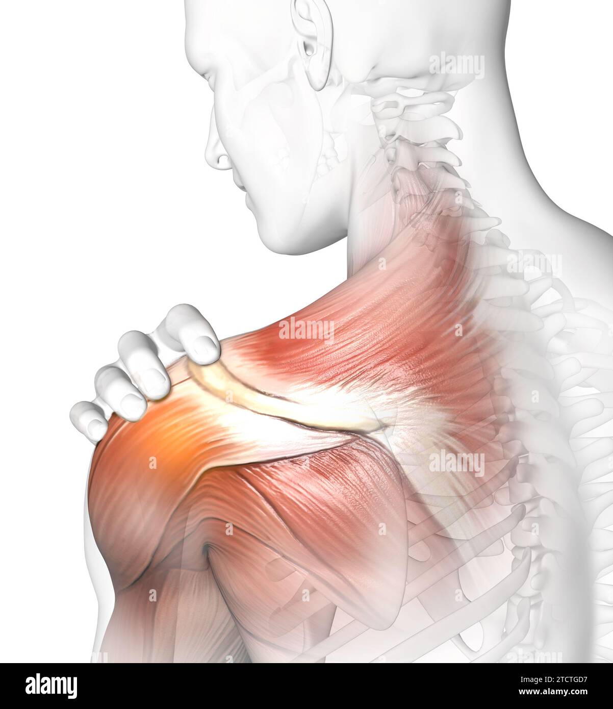 Subacromial bursitis hi-res stock photography and images - Alamy