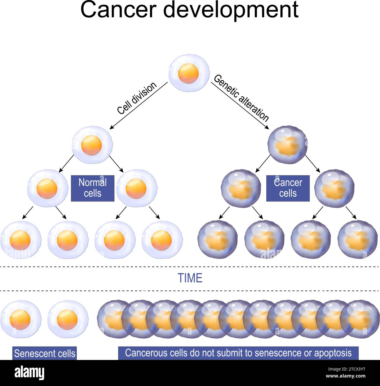 Cancer development. Carcinogenesis or Oncogenesis. Tumor cell ...