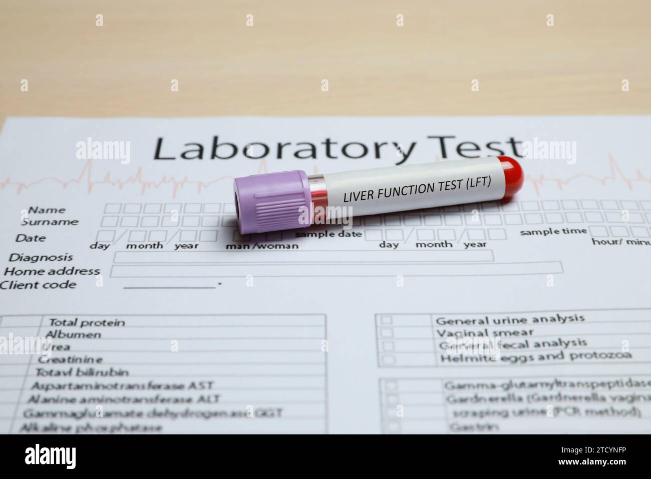 Liver Function Test. Tube with blood sample and laboratory form on ...