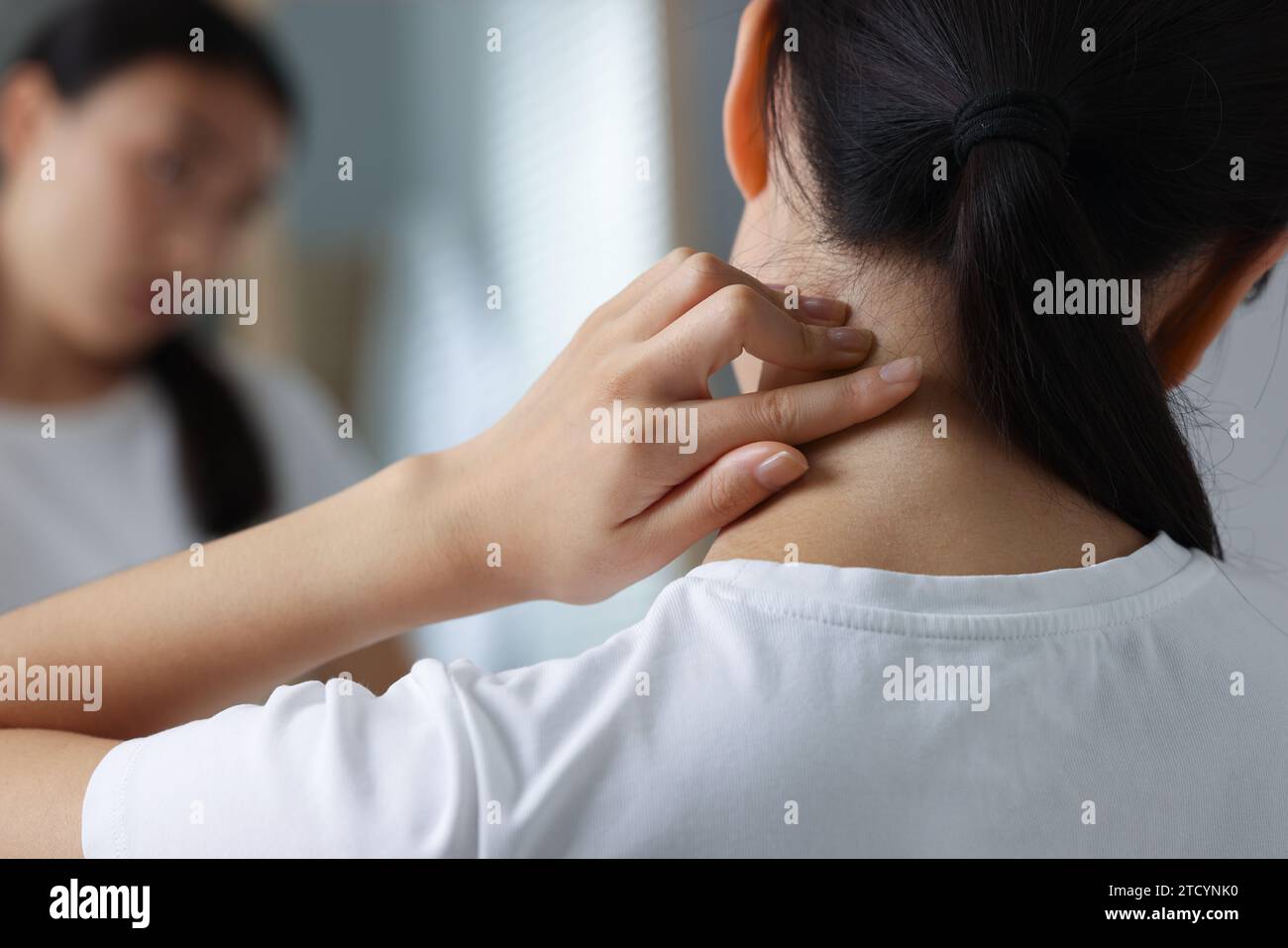 Suffering from allergy. Young woman scratching her neck near mirror ...