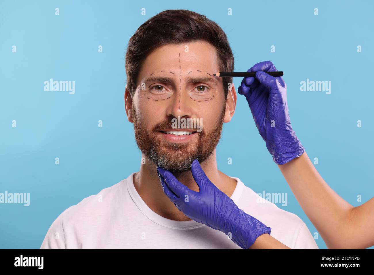 Doctor drawing marks on man's face for cosmetic surgery operation ...