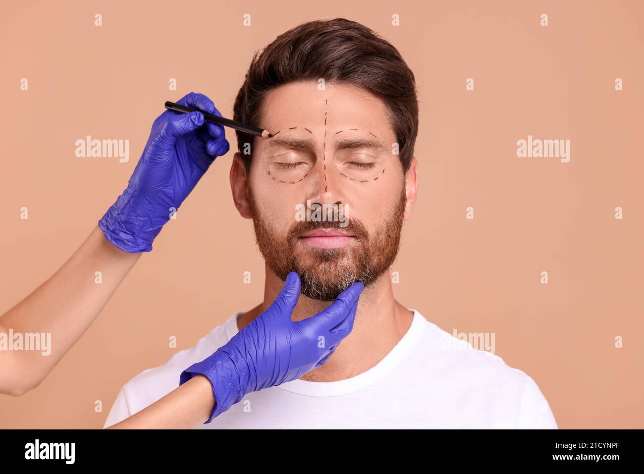 Doctor drawing marks on man's face for cosmetic surgery operation ...