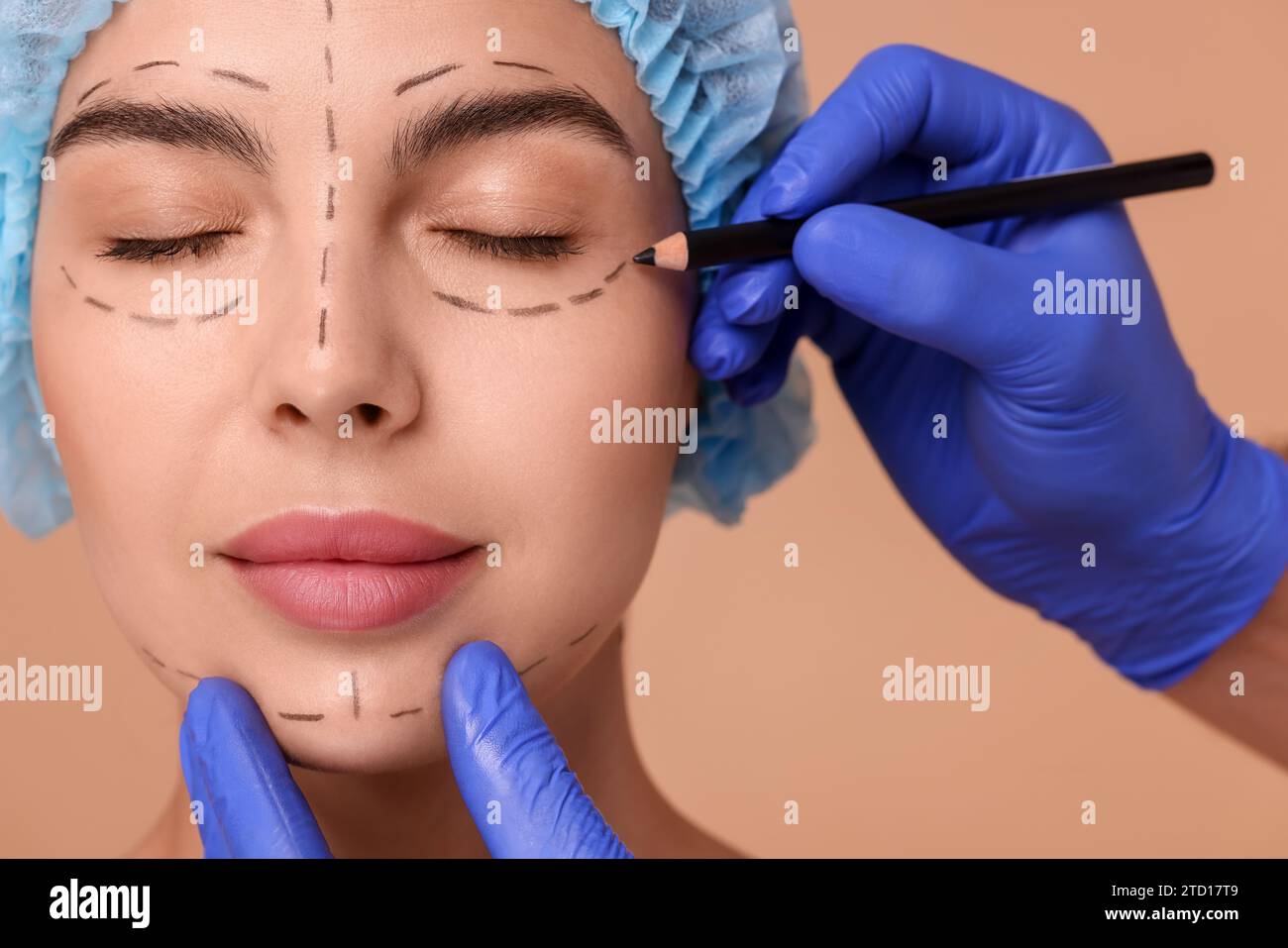 Doctor drawing marks on woman's face for cosmetic surgery operation ...