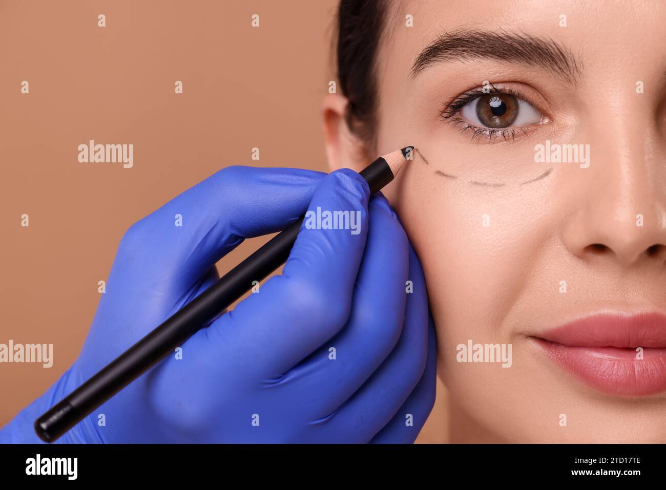 Doctor drawing marks on woman's face for cosmetic surgery operation ...
