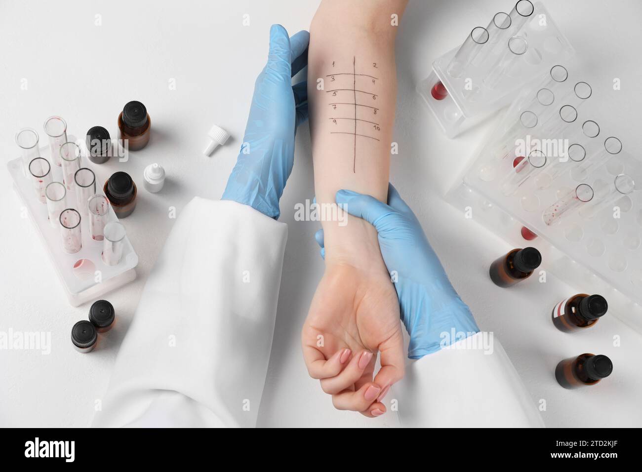Doctor doing skin allergy test at light table, top view Stock Photo - Alamy