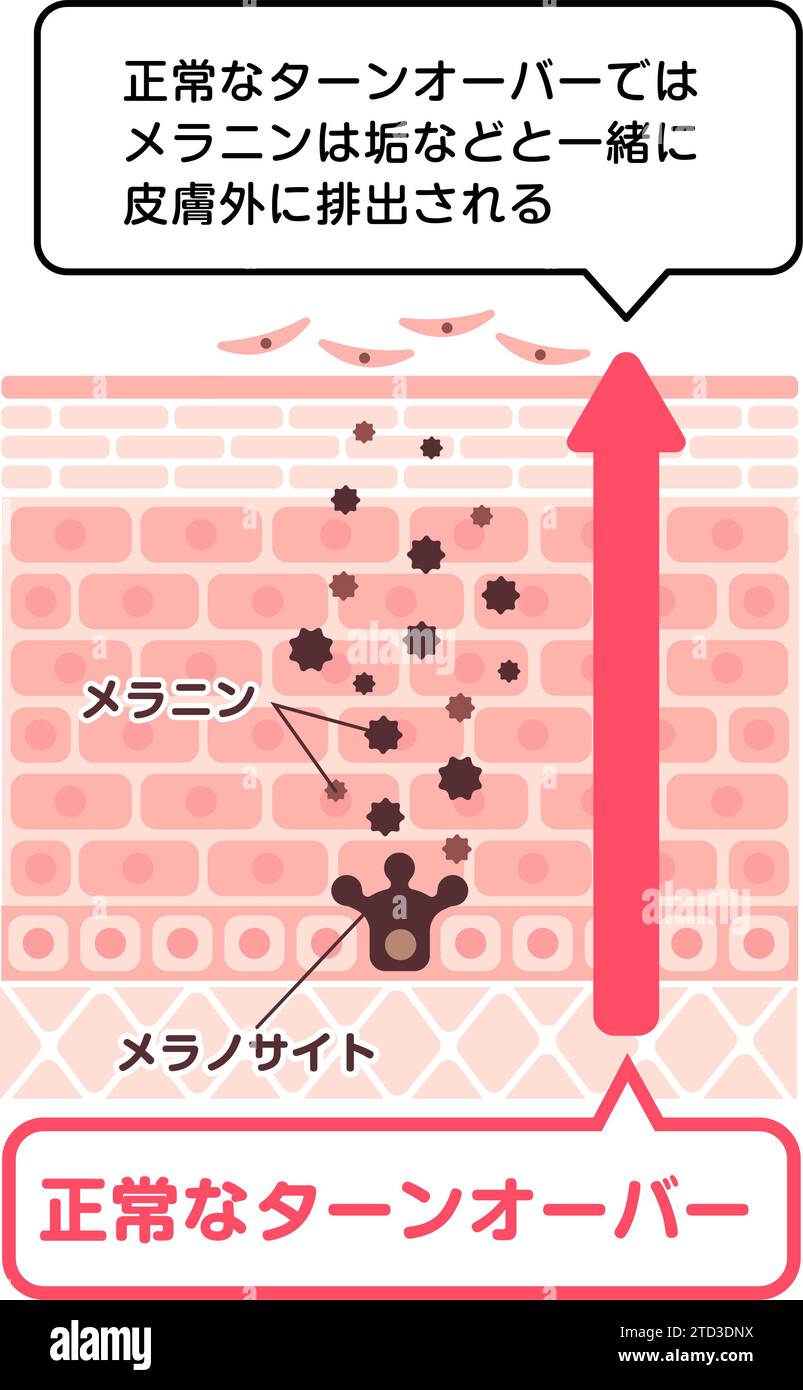 Vector illustration of normal skin turnover Stock Vector Image & Art ...