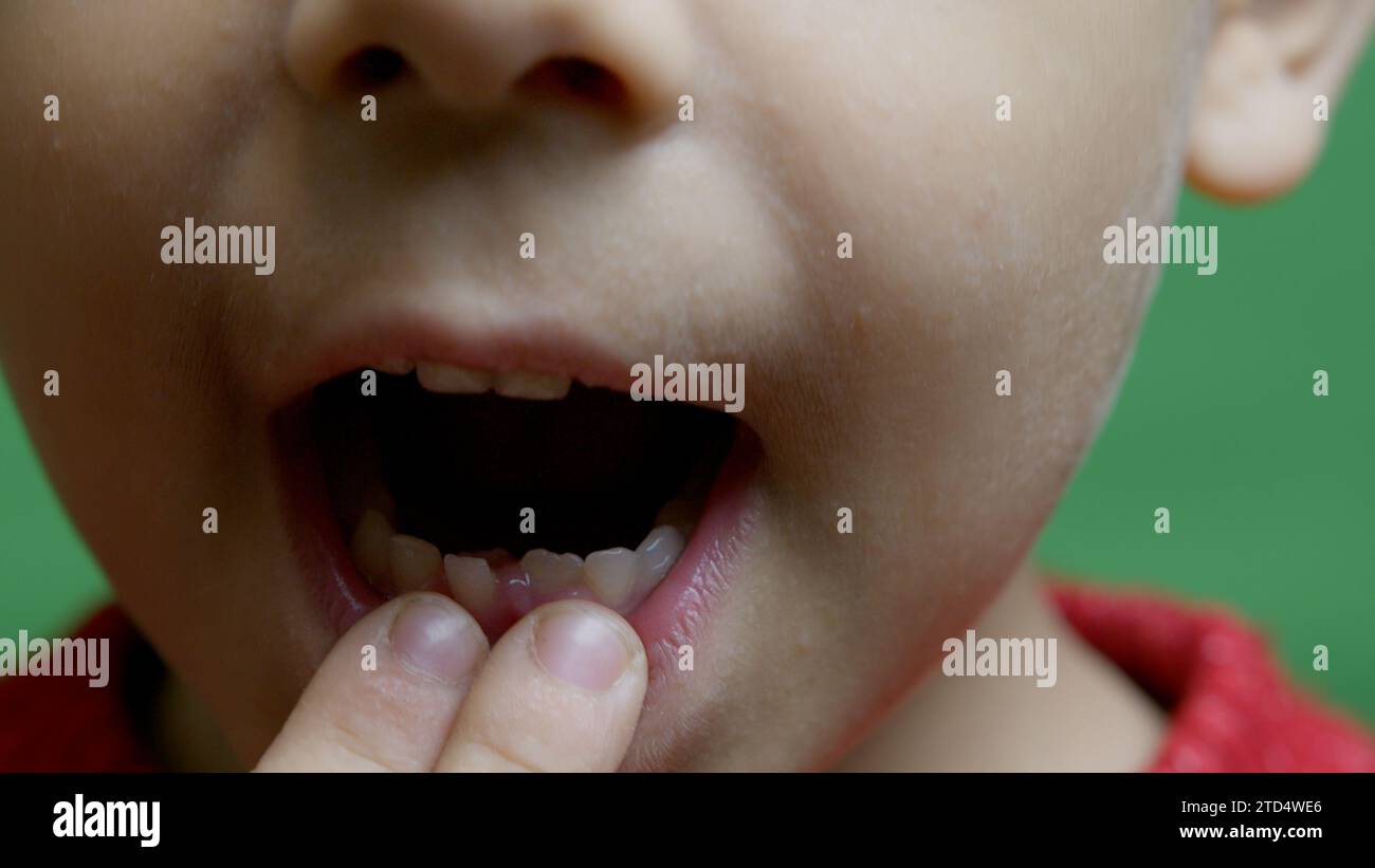Close up, boy opens his mouth and shows his milky teeth. One missing ...