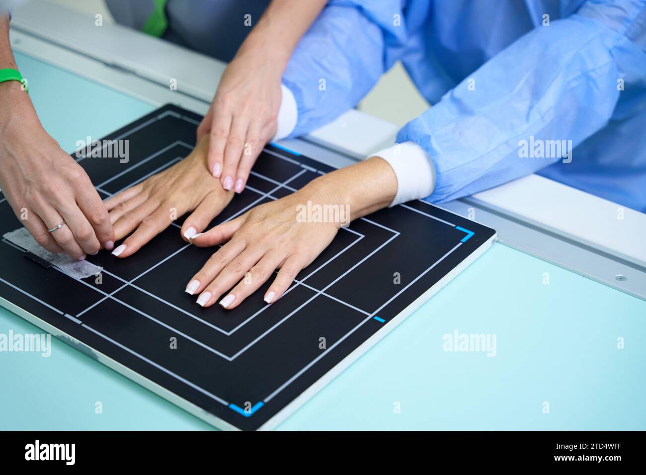 X ray image female wrist hi-res stock photography and images - Alamy