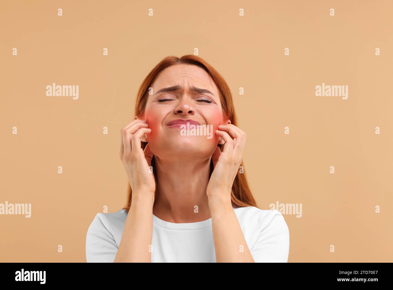 Dermatitis eczema face rash hi-res stock photography and images - Alamy